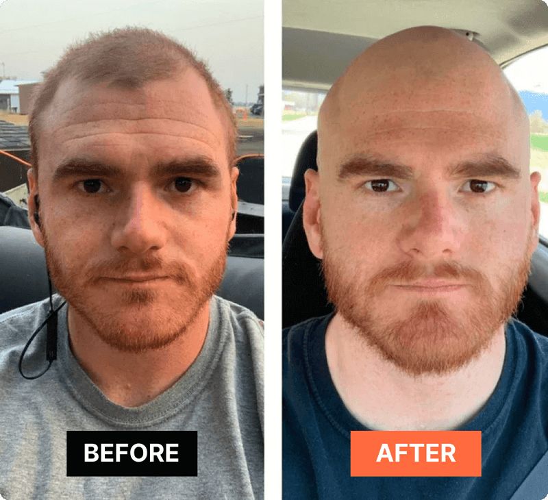 3 Minutes to a Perfect Bald Shave | Groomie Head Shaver