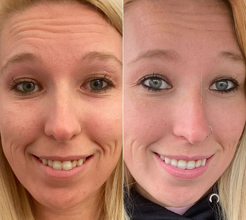 3 Minutes to a Perfect Bald Shave | Groomie Head Shaver