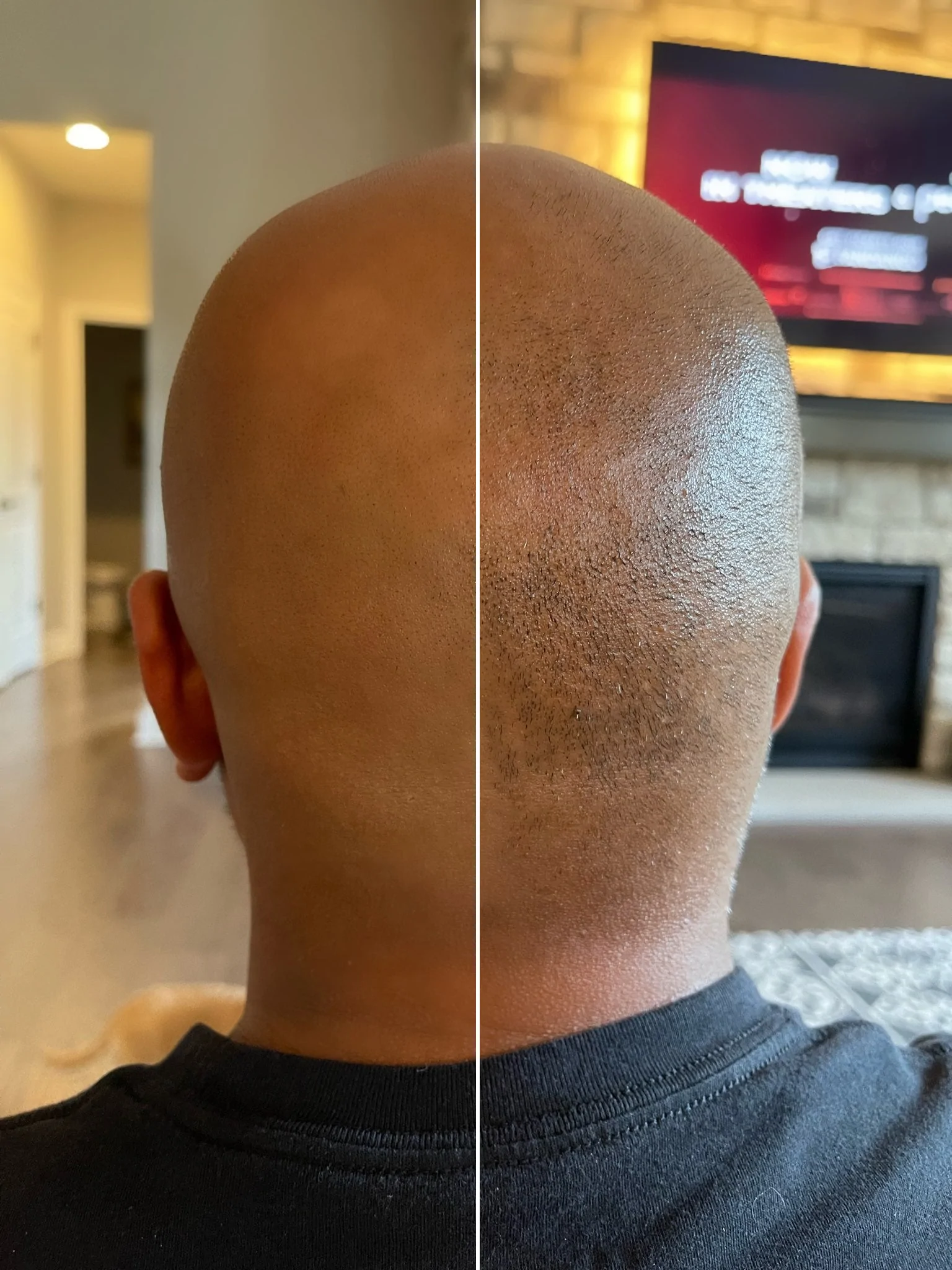 3 Minutes to a Perfect Bald Shave | Groomie Head Shaver